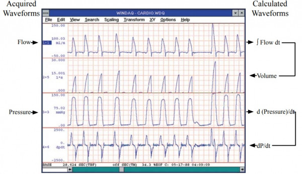 Advanced Codas Analysis Software Add On To Windaq By Dataq